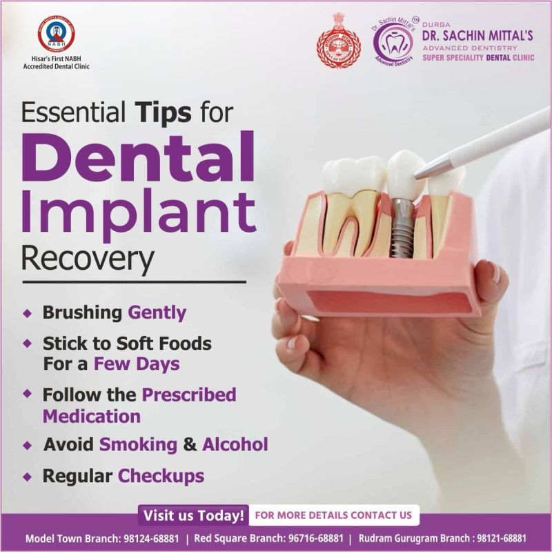 Dr. Sachin Mittal on LinkedIn: #dentalimplant #dentaltourism Dr. Sachin Mittal on LinkedIn: #dentalimplant #dentaltourism