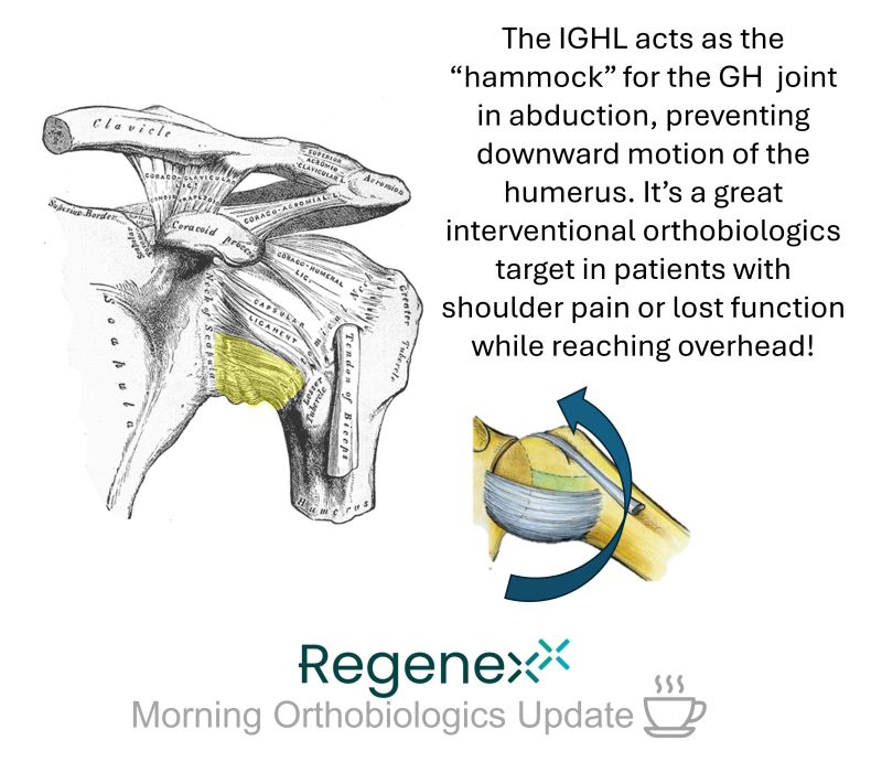 Chris Centeno, M.D. on LinkedIn: The Inferior Glenohumeral Ligament or ... Chris Centeno, M.D. on LinkedIn: The Inferior Glenohumeral Ligament or ...