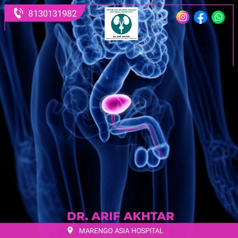 Dr Arif Akhtar on LinkedIn: #prostatecancer #cancer #prostate Dr Arif Akhtar on LinkedIn: #prostatecancer #cancer #prostate