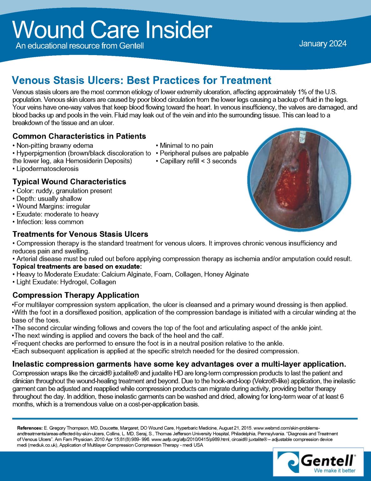Wound Care Best Practices for Venous Stasis Ulcers | David Navazio ... Wound Care Best Practices for Venous Stasis Ulcers | David Navazio ...
