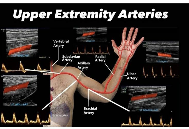 Dr Saif Ullah on LinkedIn: Spectral Doppler ultrasound,detail explanation. Dr Saif Ullah on LinkedIn: Spectral Doppler ultrasound,detail explanation.