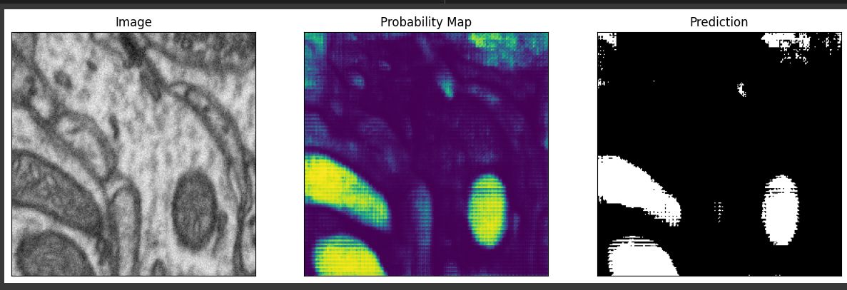 Jaykumaran R on LinkedIn: SAM Segmentation on Mitochondria - Finetuning ... Jaykumaran R on LinkedIn: SAM Segmentation on Mitochondria - Finetuning ...