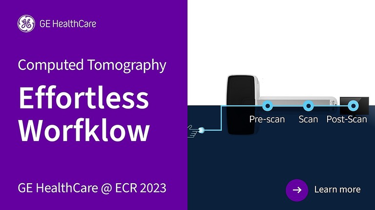 Sonia Sahney on LinkedIn: Effortless Workflow to Optimize CT Workflow ... Sonia Sahney on LinkedIn: Effortless Workflow to Optimize CT Workflow ...