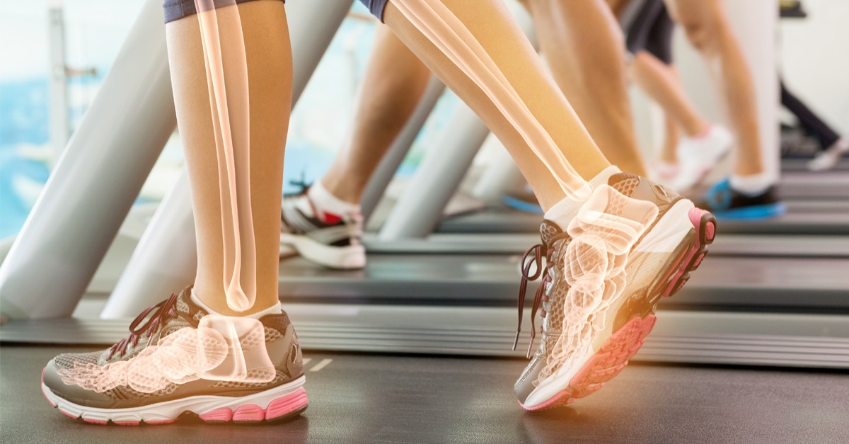 SR CarnoSyn® on LinkedIn: “In the US, annual incidence of bone ... SR CarnoSyn® on LinkedIn: “In the US, annual incidence of bone ...