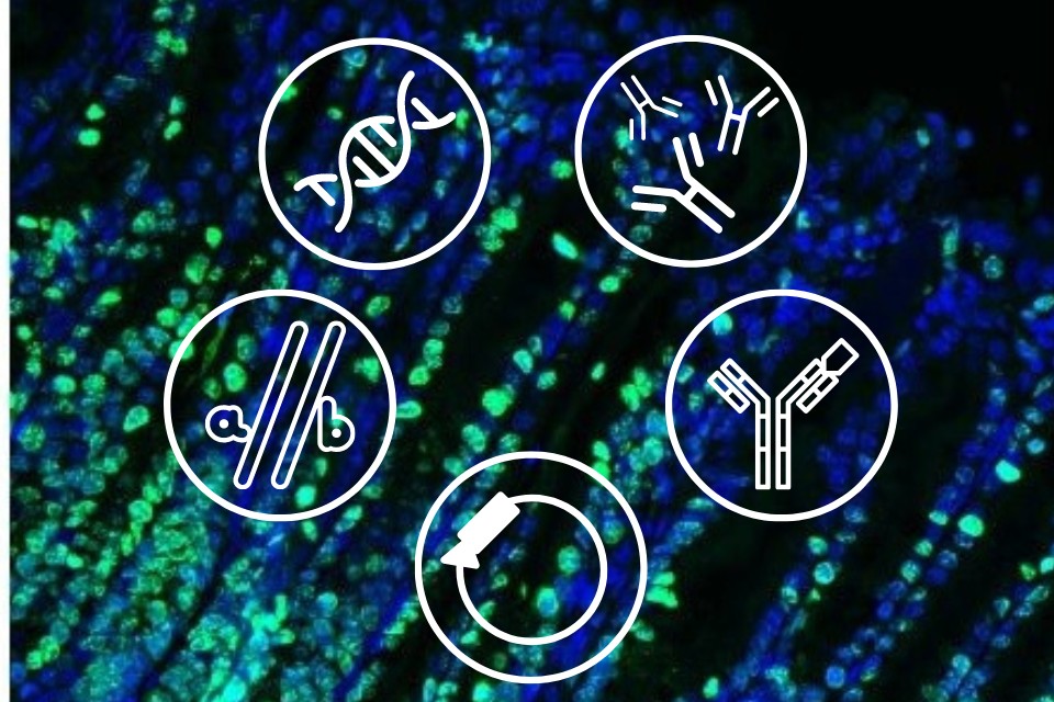 Melanie (Bing Yu) Zou, MS on LinkedIn: Supplier antibody validation ... Melanie (Bing Yu) Zou, MS on LinkedIn: Supplier antibody validation ...